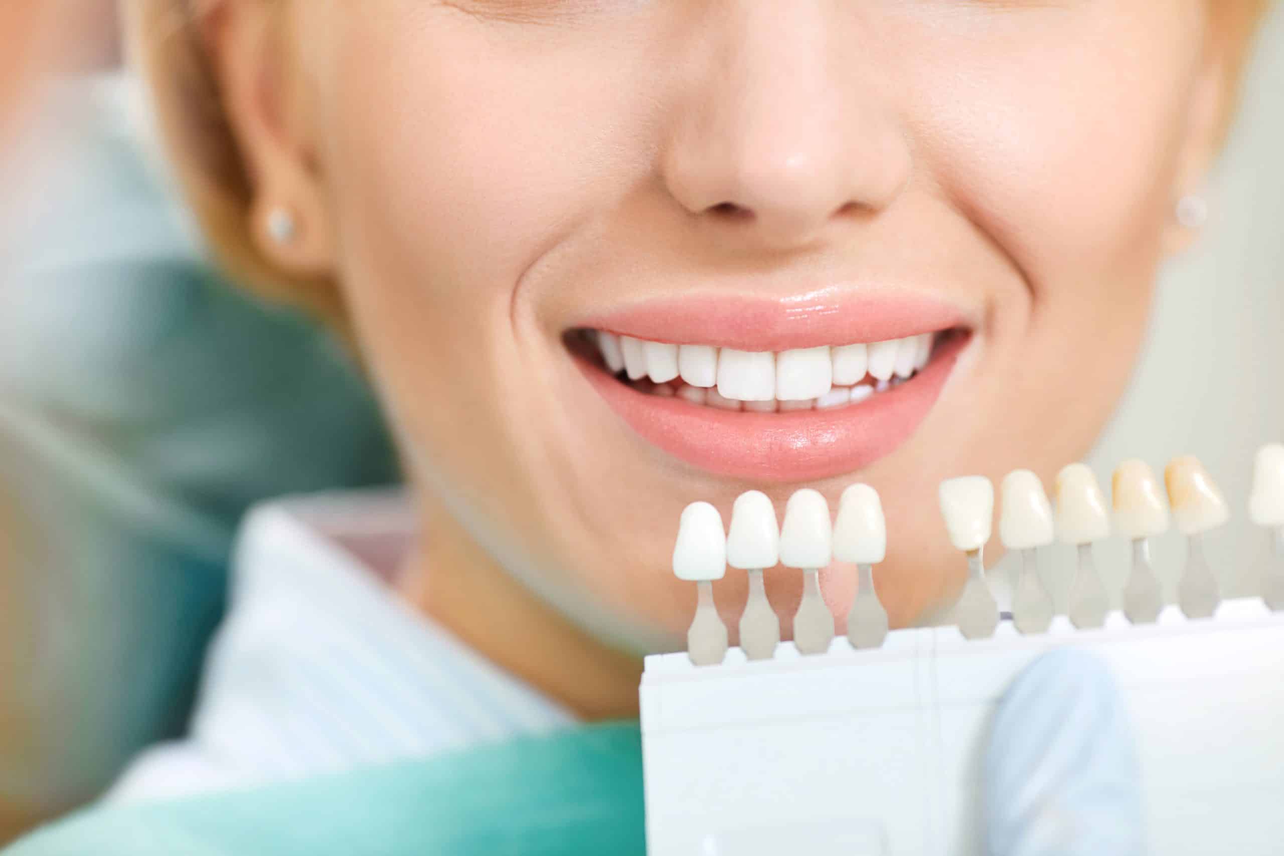 Let’s Talk Teeth Whitening | Azalea Dental